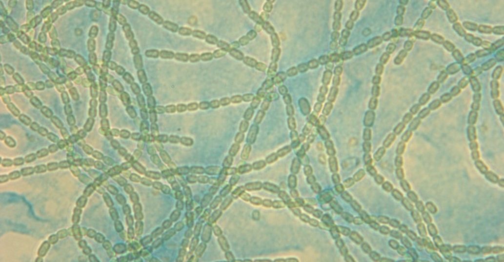 Want to go green and circular? Try Microalgae! - Elävää tiedettä